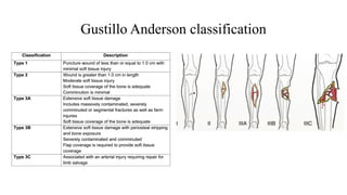 Introduction to fracture and classification | PDF