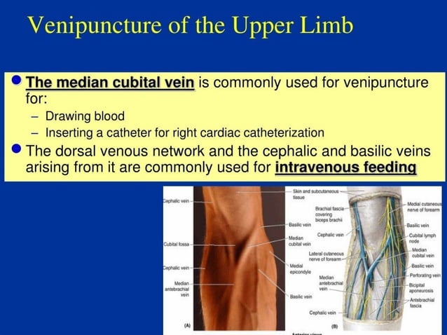 upper limb- anterior compartment of the arm | PPT