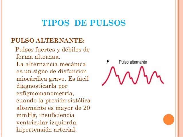 8 generalidades de expl sv