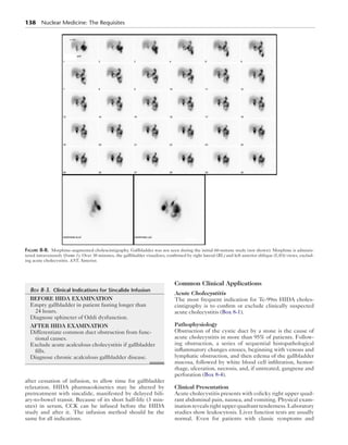 Understanding Hida Scan Results
