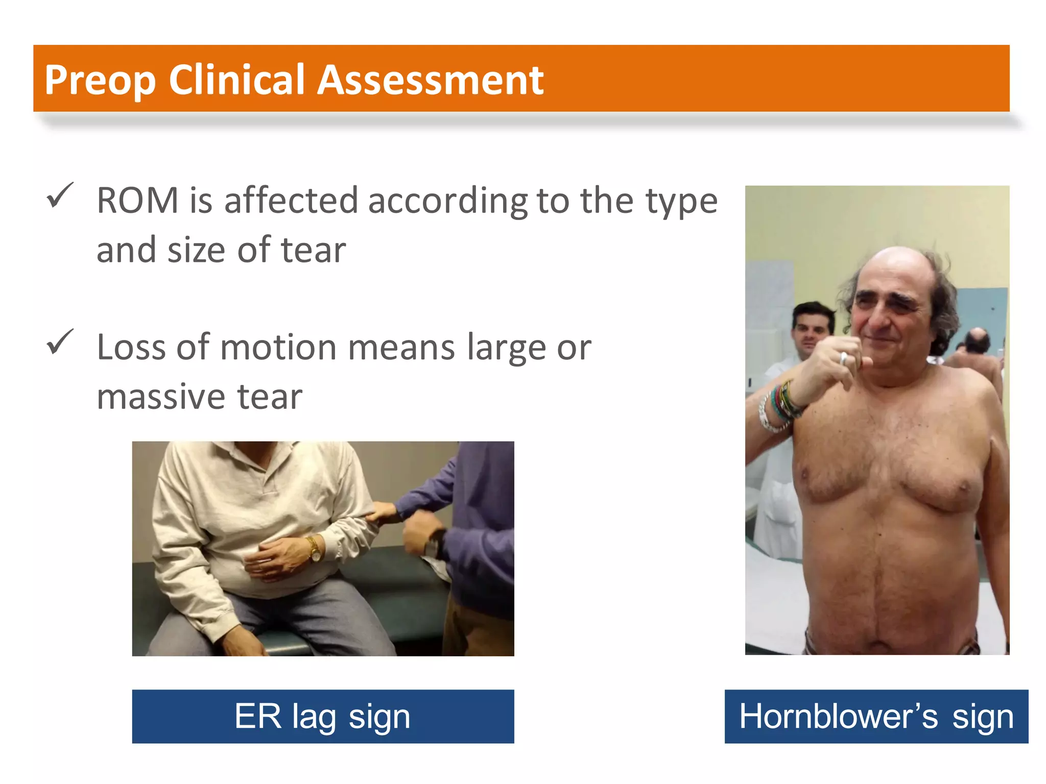 Arthroscopic management of rotator cuff tears larissa 2016 | PDF