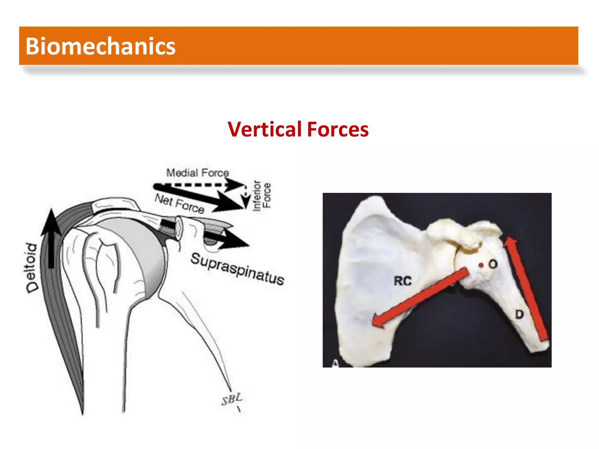 Arthroscopic management of rotator cuff tears larissa 2016 | PDF