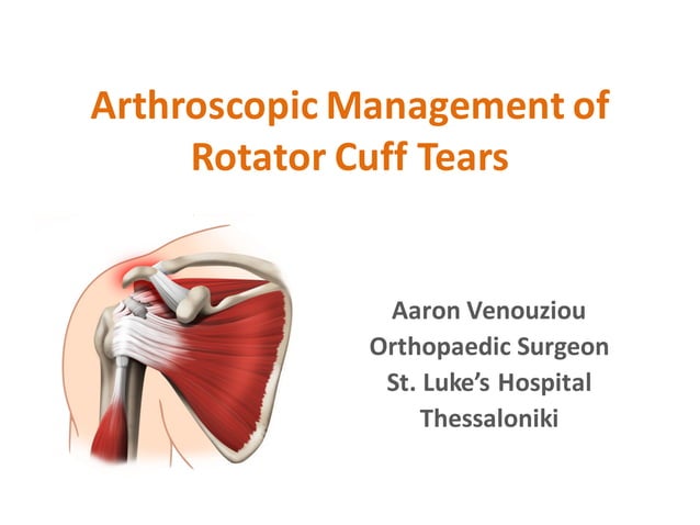Arthroscopic management of rotator cuff tears larissa 2016 | PPT