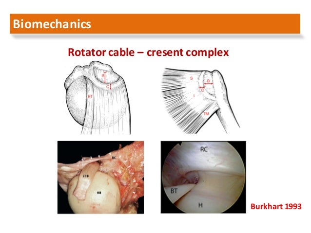 Arthroscopic management of rotator cuff tears larissa 2016