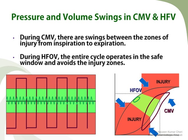 HFOV - High Frequency Oscillatory Ventilation | PDF | Lung and ...