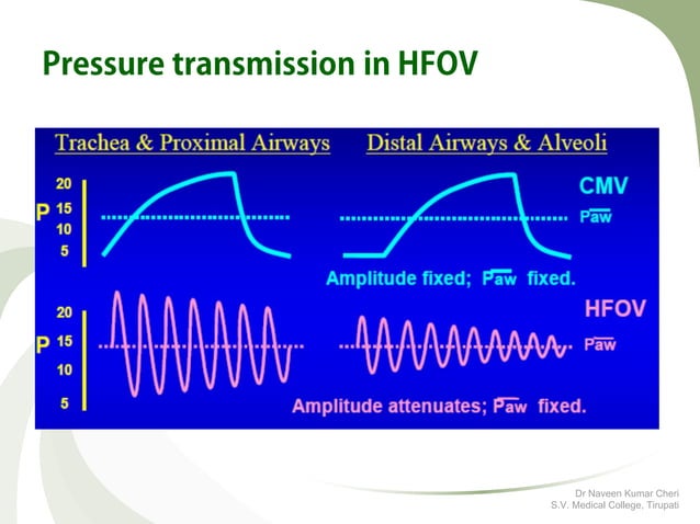 HFOV - High Frequency Oscillatory Ventilation | PDF | Lung and ...