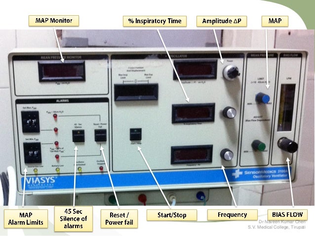 HFOV - High Frequency Oscillatory Ventilation
