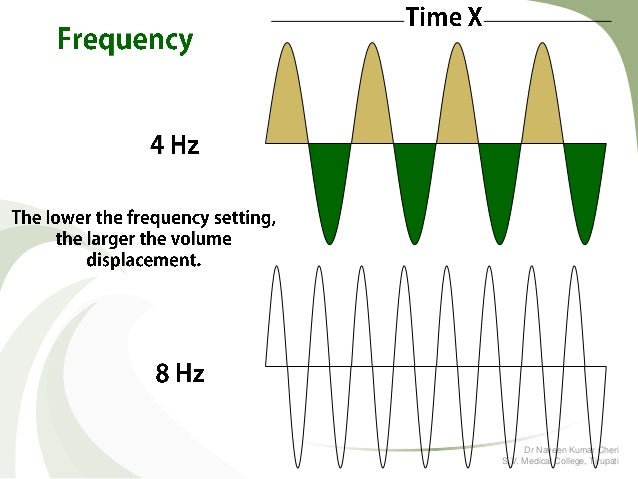 HFOV - High Frequency Oscillatory Ventilation