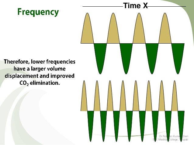 HFOV - High Frequency Oscillatory Ventilation