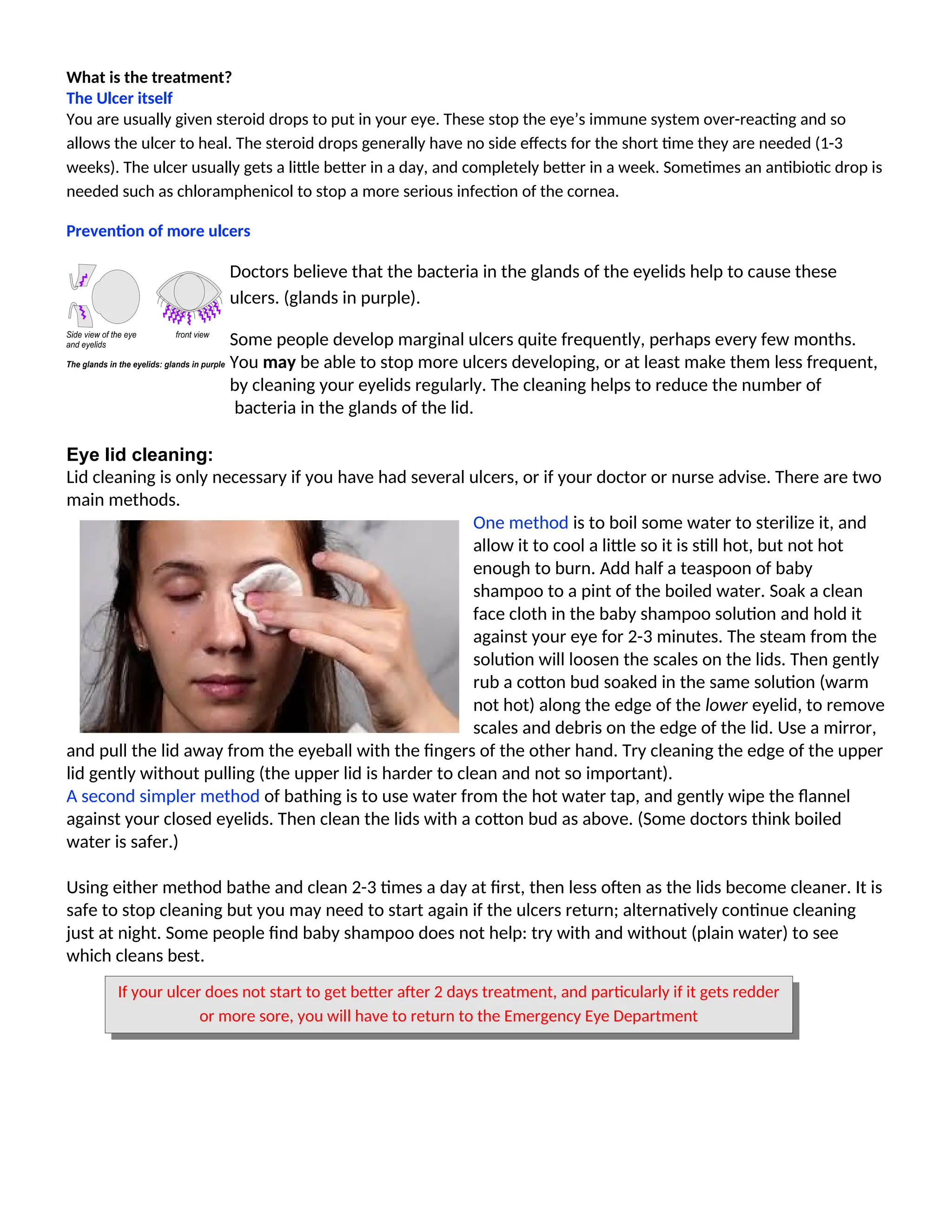 Marginal Corneal Ulcers patient education | DOCX