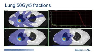 Professor Maria Hawkins - UK SABR Service Development Experiences | PPTX