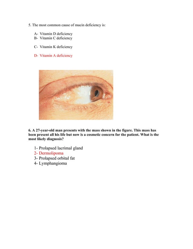 8 MCQs (Multiple Choice Questions) -ophthalmology web quiz.doc
