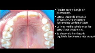 CASO_CLINICO_ORTODONCIA_ paciente Diana Ordóñez Castañeda | PPTX
