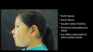 CASO_CLINICO_ORTODONCIA_ paciente Diana Ordóñez Castañeda | PPTX