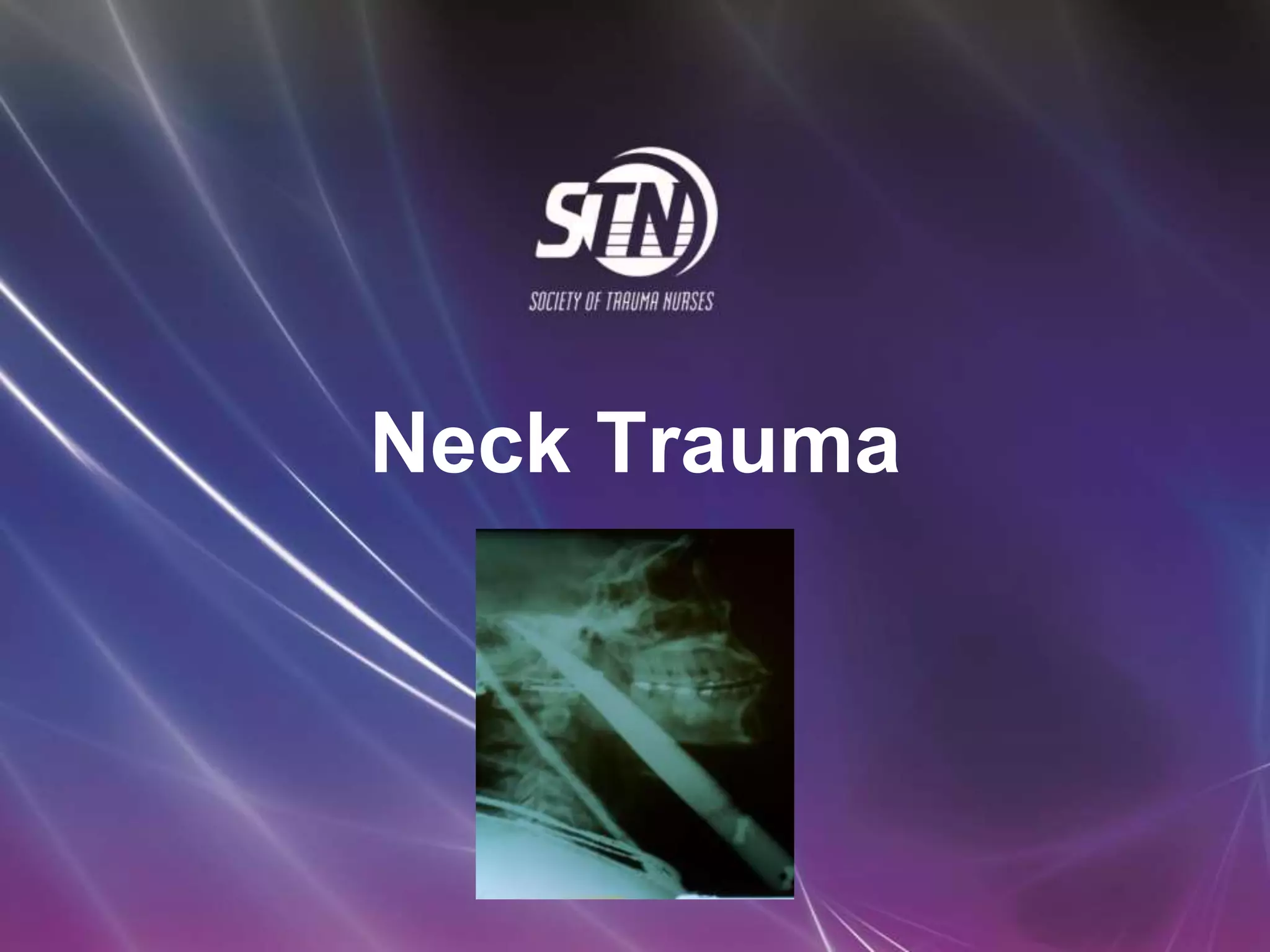 8_Neck Trauma.pptx