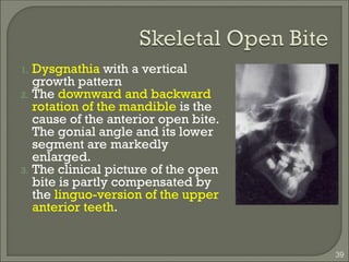 OPENBITE IN ORTHODONTICS-ETIOLOGY, DIAGNOSIS & MANAGEMENT .ppt