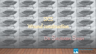 SICS WOUND CONSTRUCTION _ Beginner's Guide | PPTX