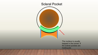 SICS WOUND CONSTRUCTION _ Beginner's Guide | PPTX