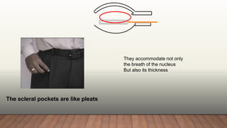 SICS WOUND CONSTRUCTION _ Beginner's Guide | PPTX