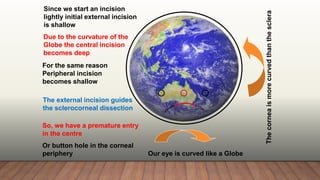 SICS WOUND CONSTRUCTION _ Beginner's Guide | PPTX