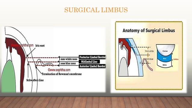 SICS WOUND CONSTRUCTION _ Beginner's Guide | PPTX