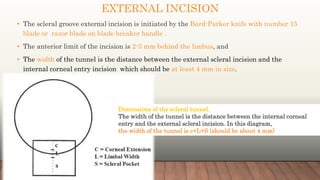 SICS WOUND CONSTRUCTION _ Beginner's Guide | PPTX