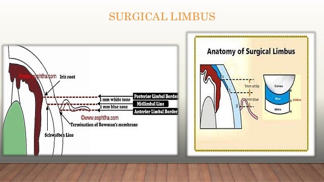 SICS WOUND CONSTRUCTION _ Beginner's Guide