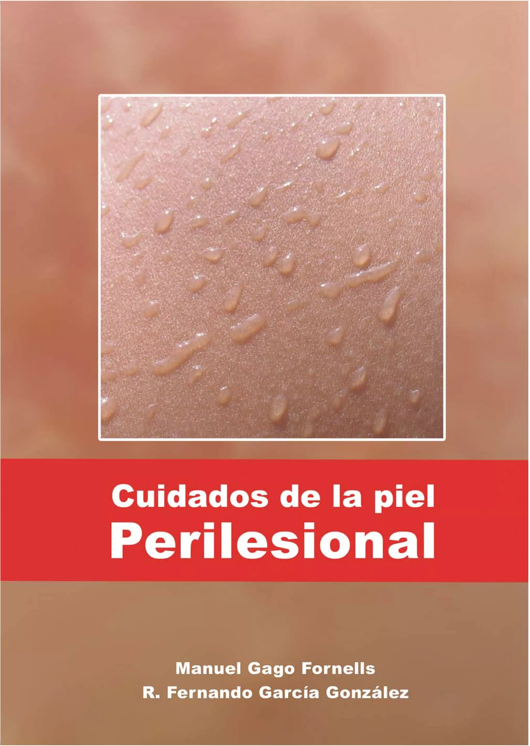Cuidados de la Piel Perilesional | PDF