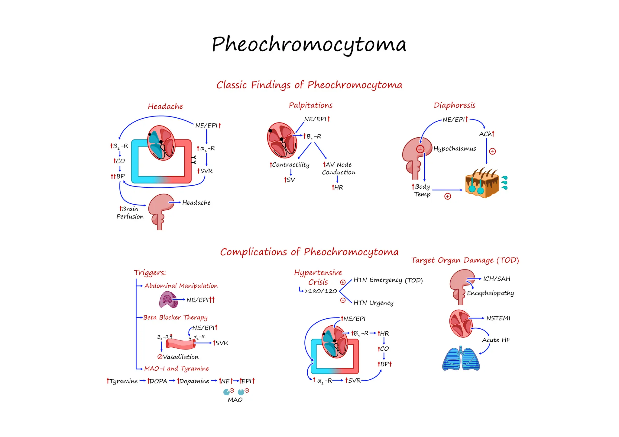 eight (8)• Pheochromocytoma [Illustrations Key].pdf