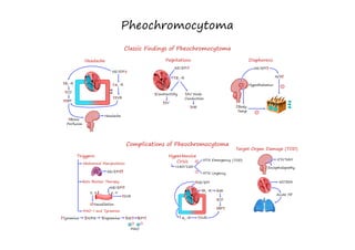 eight (8)• Pheochromocytoma [Illustrations Key].pdf