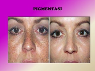 8 pigmentasi amy&imah | PPTX