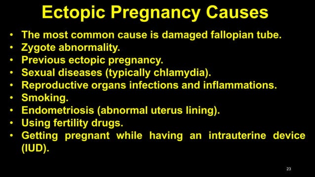Postpartum Hemorrhage (PPH) and Ectopic Pregnancy | PPTX