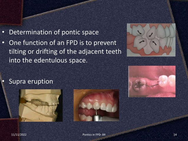 8 Pontics IN FPD.pptx