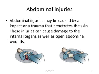 8 provide frist aid trauma | PPTX