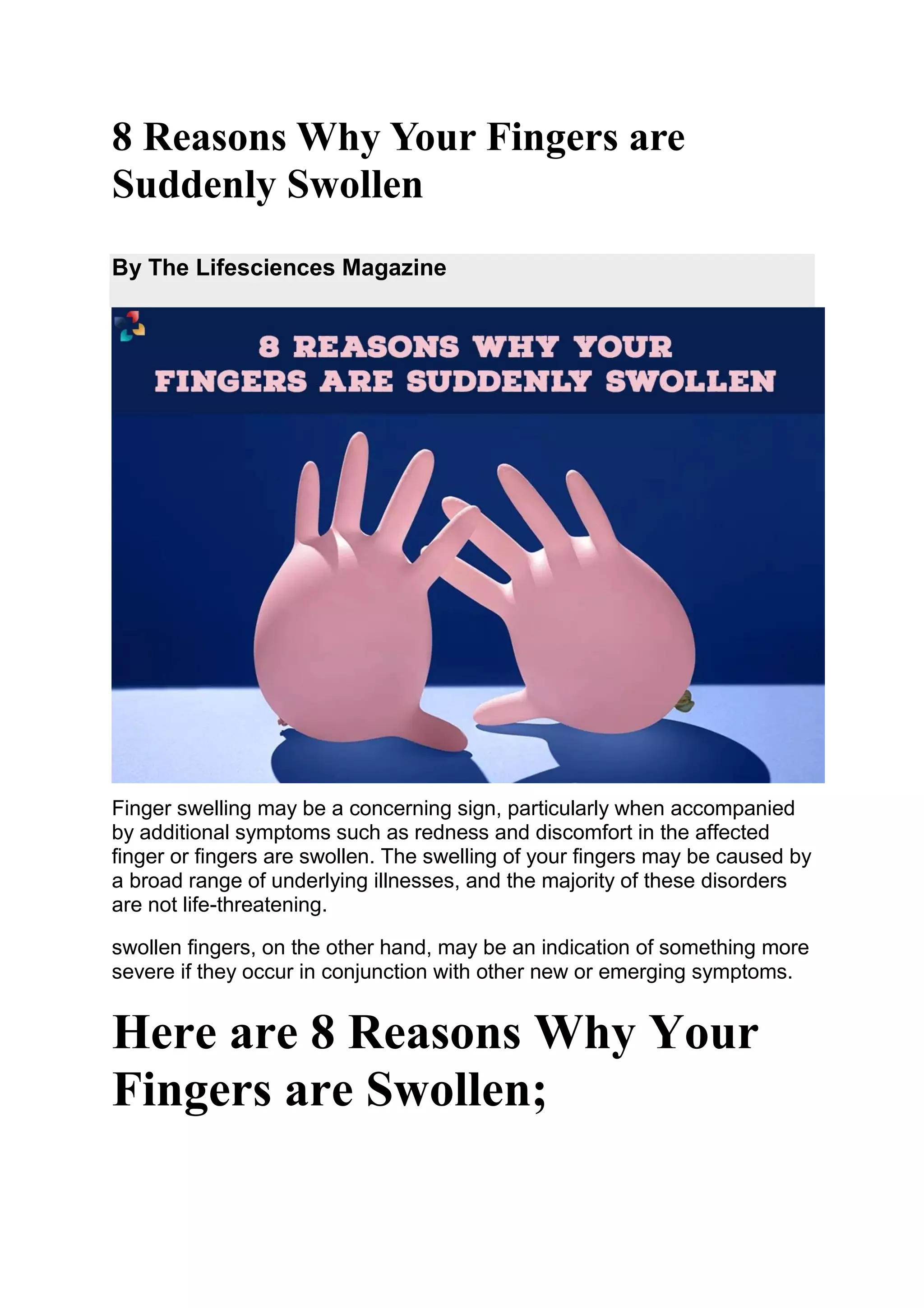8 Reasons Why Your Fingers are Suddenly Swollen.pdf