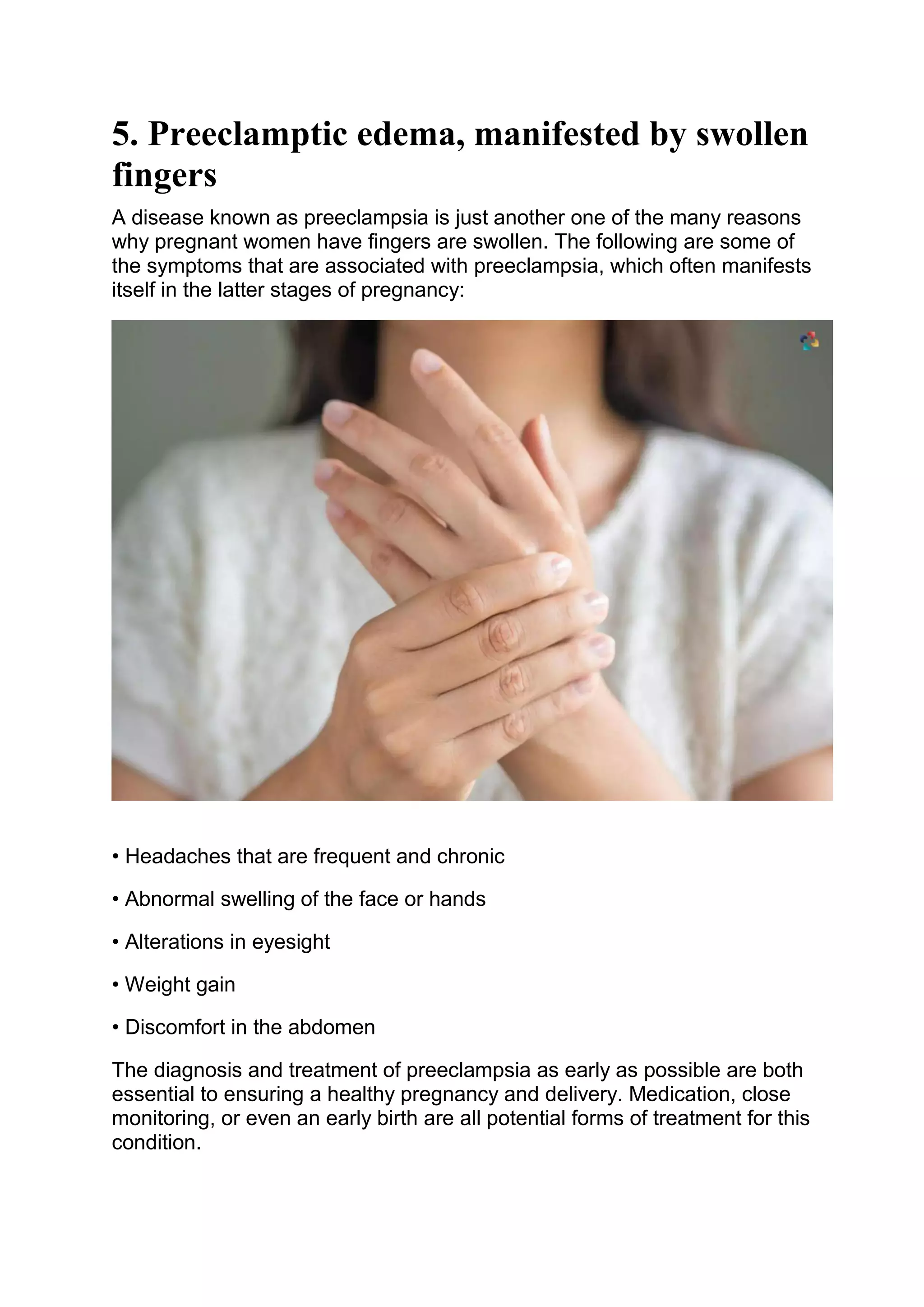 8 Reasons Why Your Fingers are Suddenly Swollen.pdf