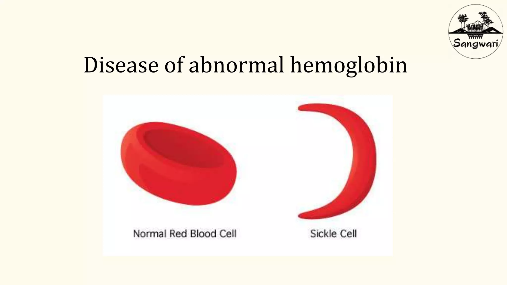 Sickle cell disease nursing care.pptx