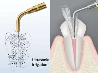 Root Canal Irrigants | PPT