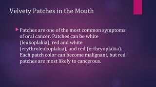 8 signs of oral cancer to watch out | PPT