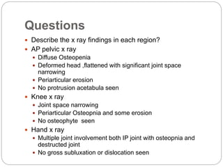 8th case discussion | PPT