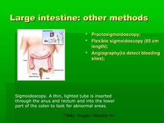 large intestine | PPT