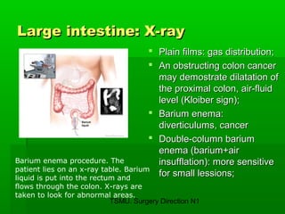 large intestine | PPT