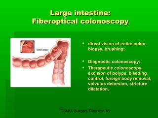 large intestine | PPT