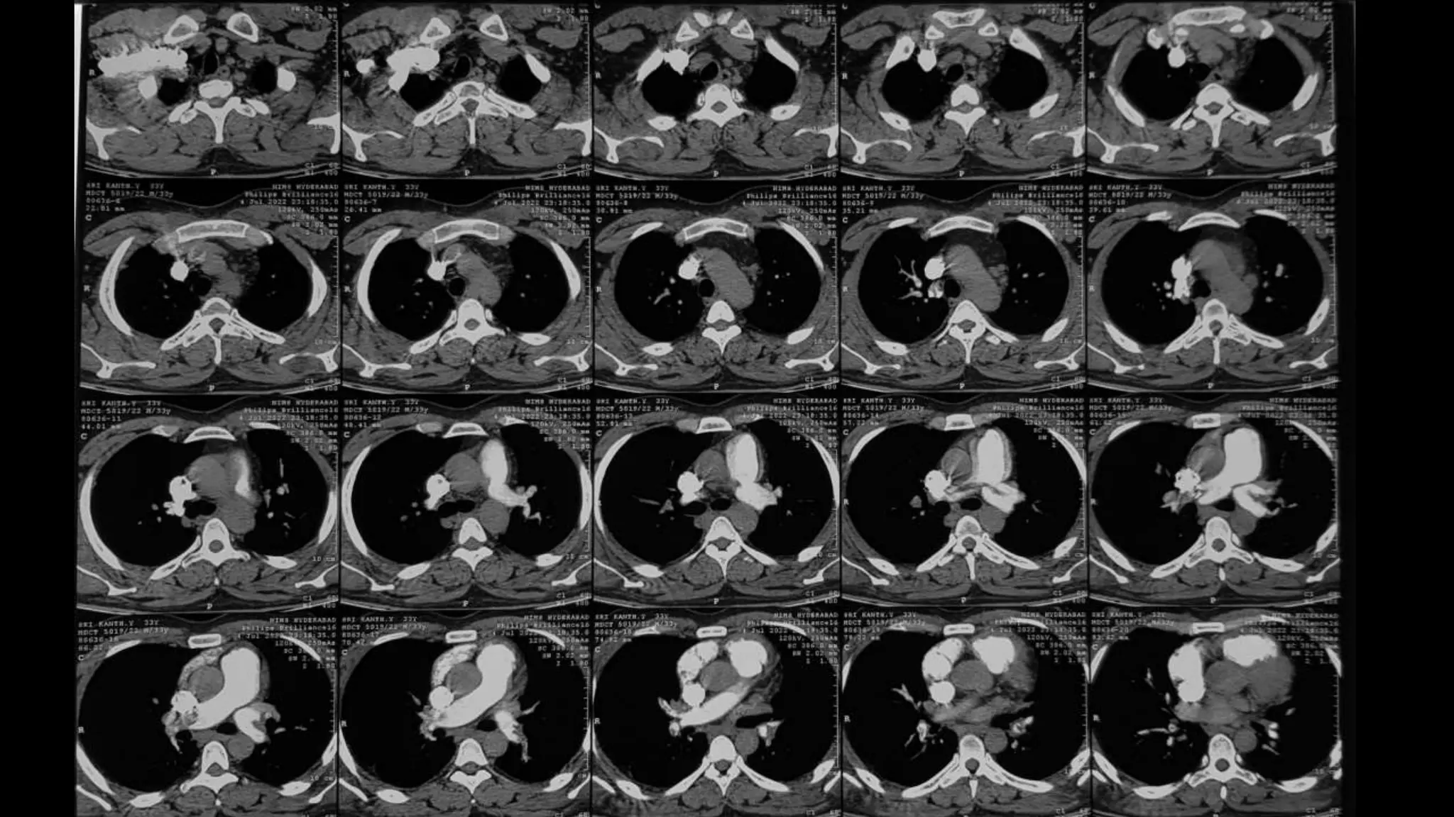 8th july chest rad indexed.pptx