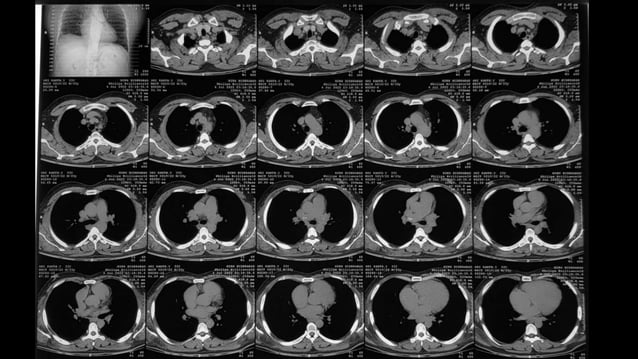 8th july chest rad indexed.pptx