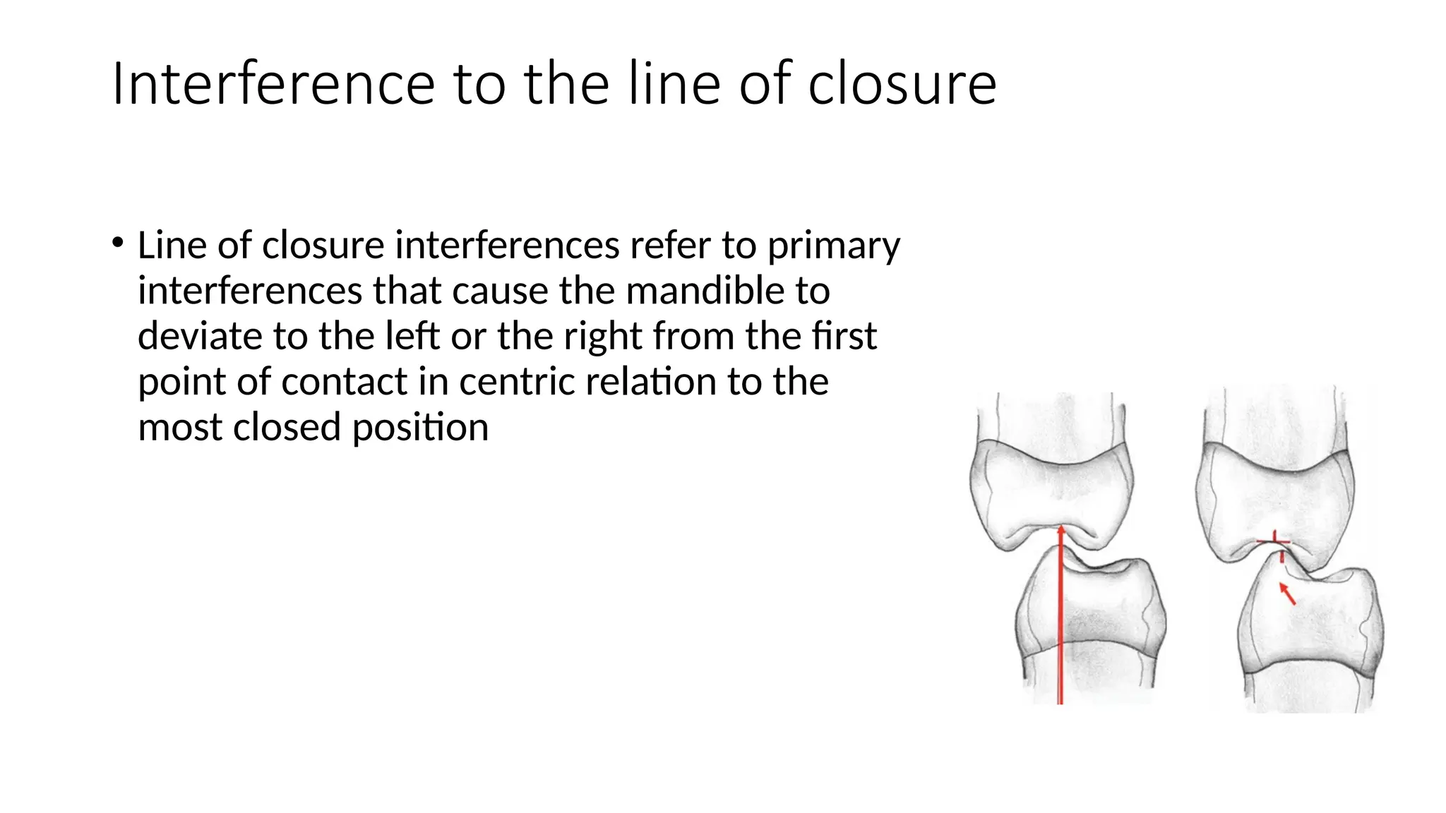 8th lec. Occlusal Equilibration.....pptx
