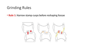 8th lec. Occlusal Equilibration.....pptx