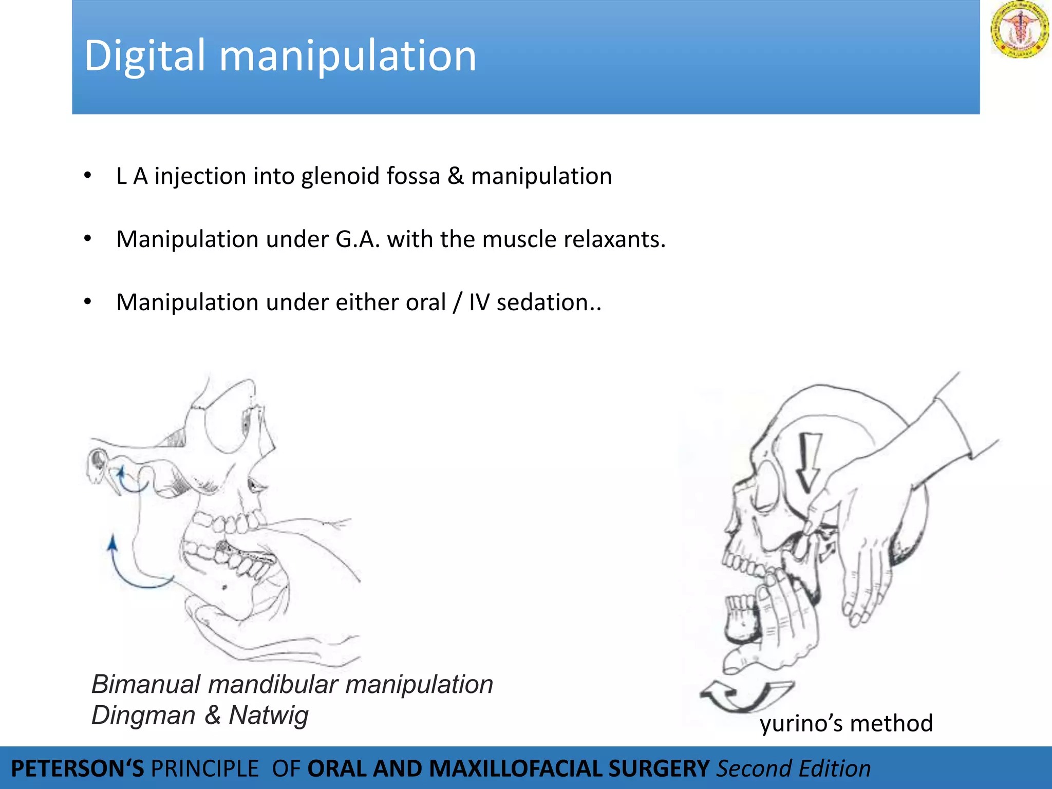 Temporomandibular joint dislocation | PPTX