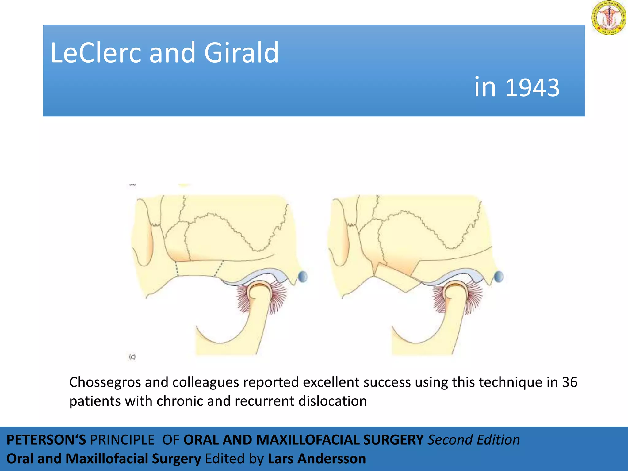 Temporomandibular Joint Dislocation Pptx