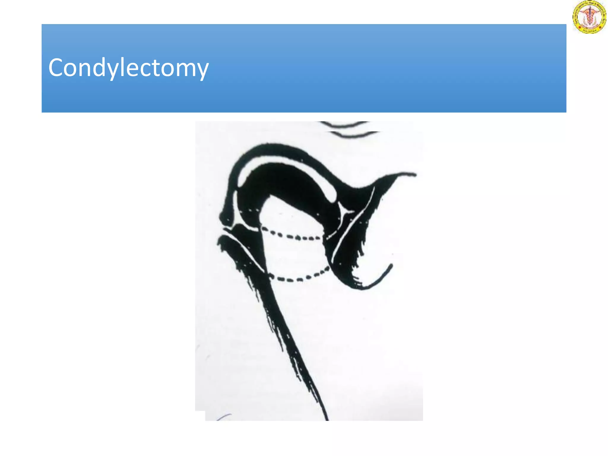 Temporomandibular joint dislocation | PPTX